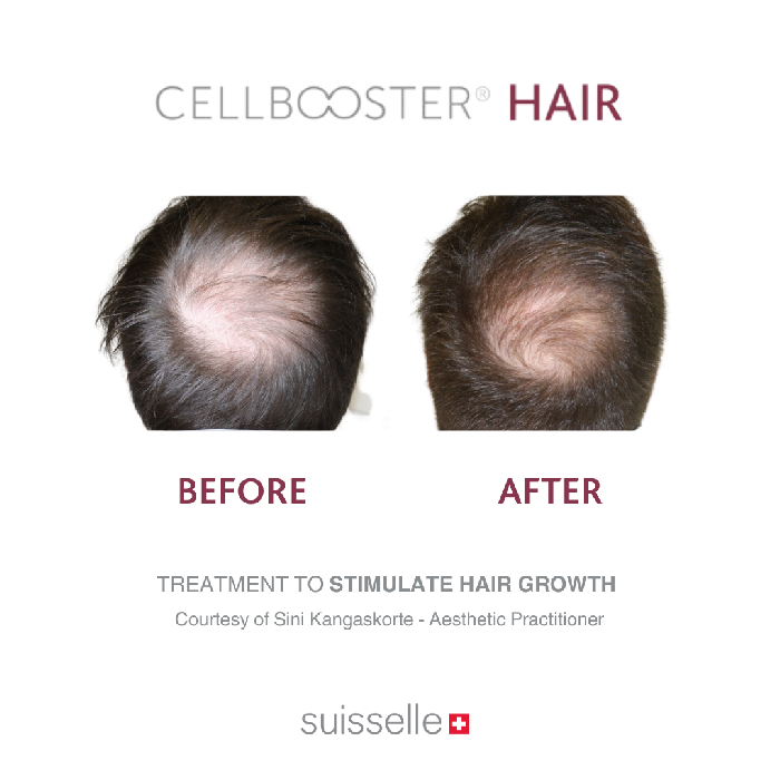 Cellbooster Hair :: Blume Clinic